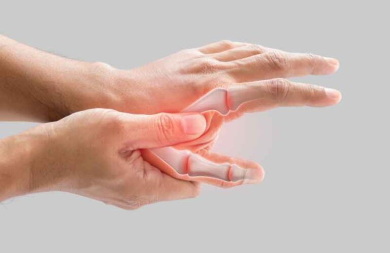 Polyarthrite rhizomélique : peut-on en guérir ? Les réponses médicales ...